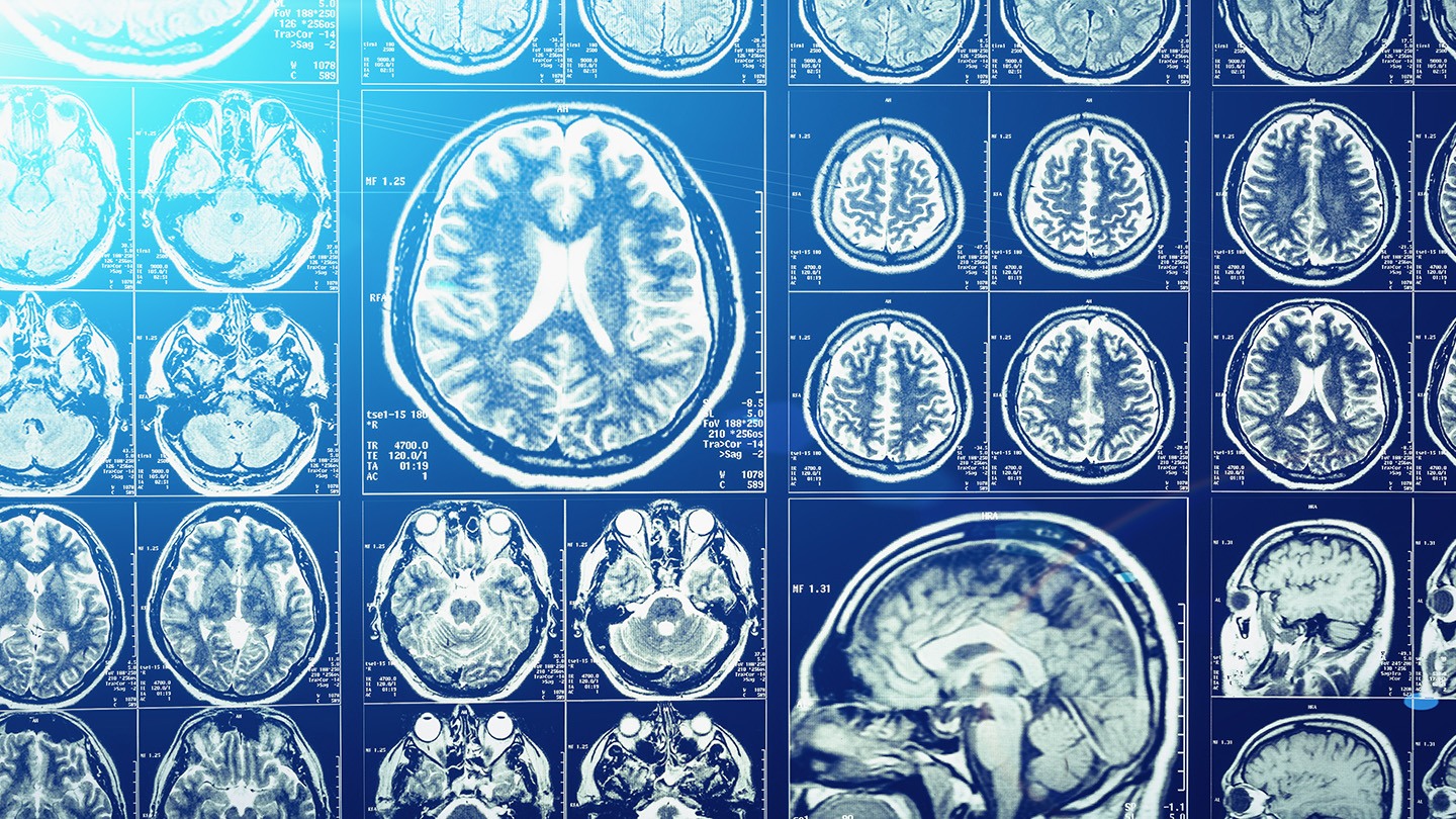 Clinical Divisions | Department of Neurology | Medical School | Brown University